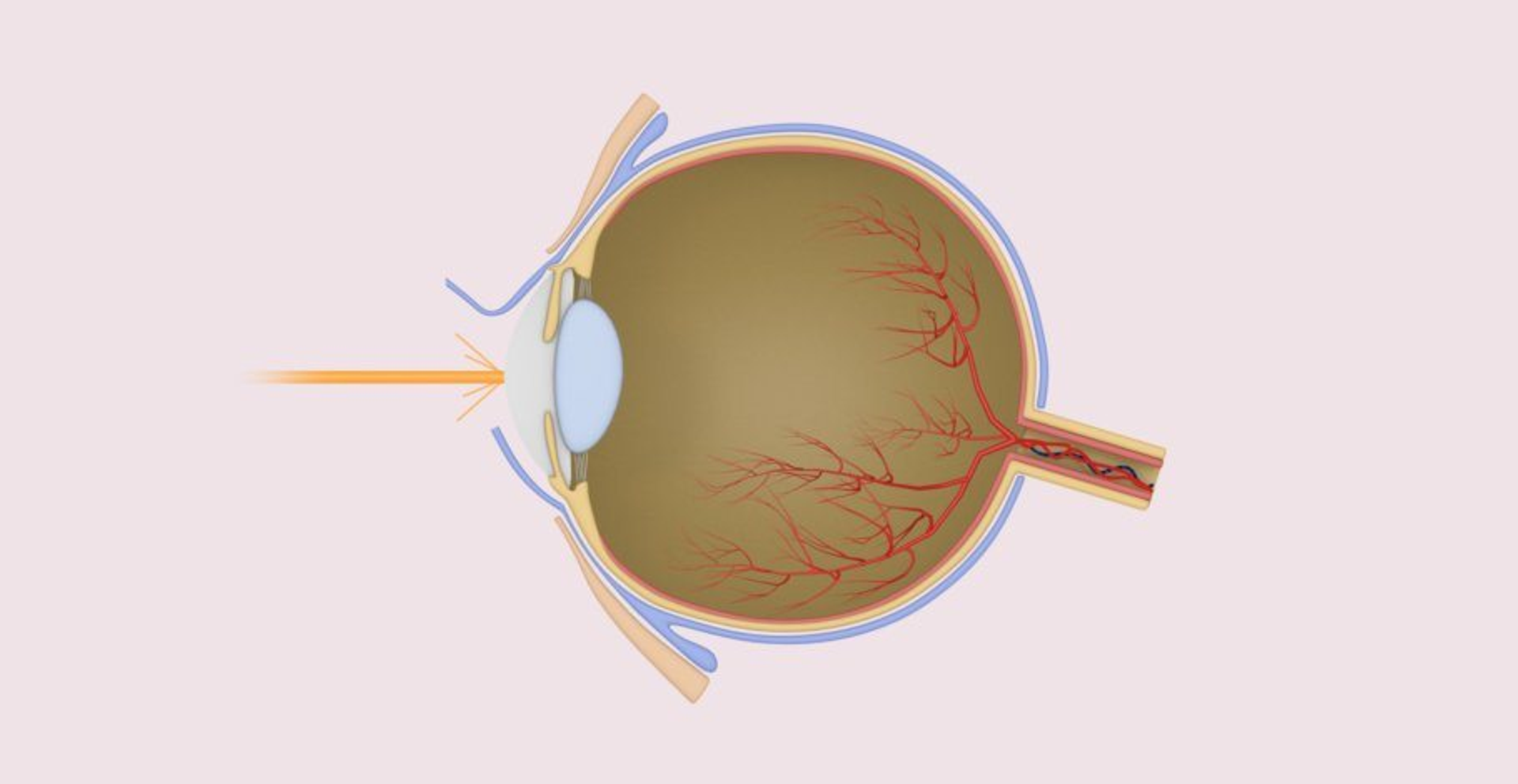Farsightedness (hyperopia, hypermetropia)